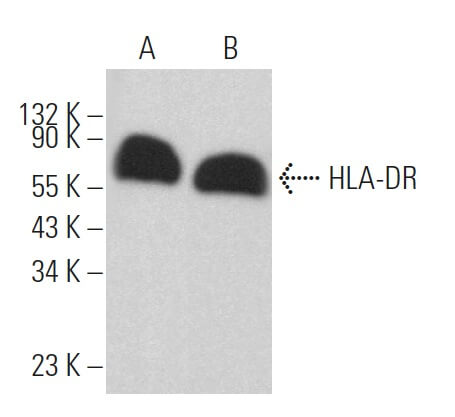 HLA-DR Antibody (2.06) | SCBT - Santa Cruz Biotechnology
