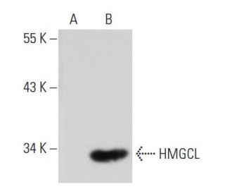HMGCL Antibody (63Z) | SCBT - Santa Cruz Biotechnology