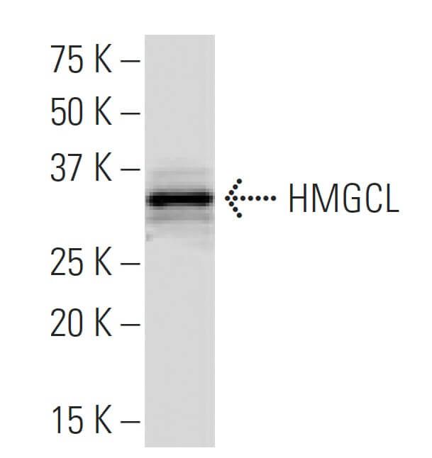 HMGCL Antibody (63Z) | SCBT - Santa Cruz Biotechnology