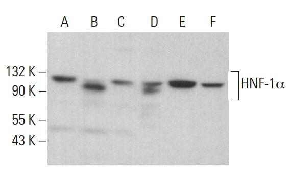 HNF-1α抗体 (F-7) | SCBT - Santa Cruz Biotechnology