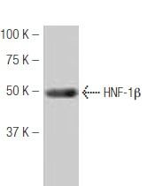 HNF-1β Antibody (94.8) | SCBT - Santa Cruz Biotechnology