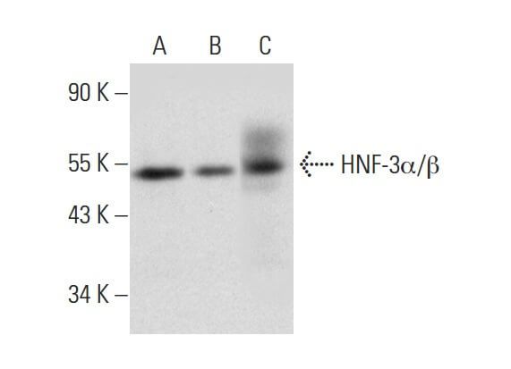 HNF-3α/β Antibody (E-4) | SCBT - Santa Cruz Biotechnology