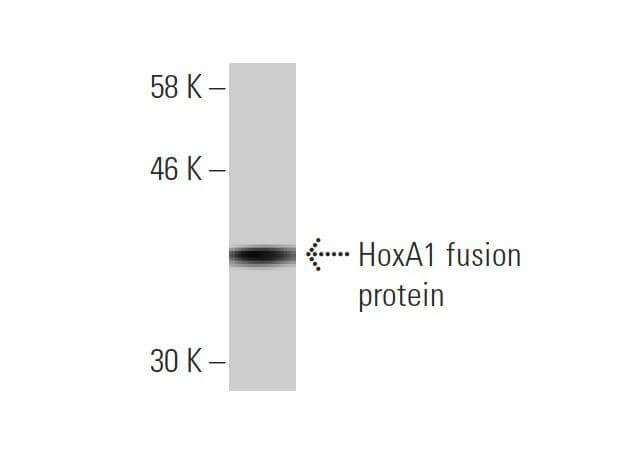 HoxA1 Antibody (1E10) | SCBT - Santa Cruz Biotechnology