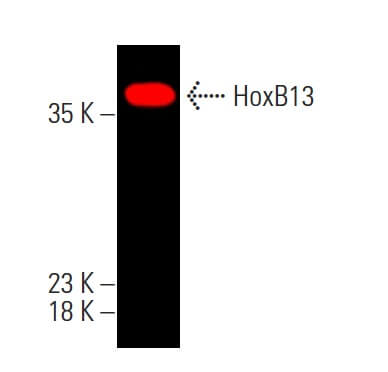 Anti-HoxB13 Antibody (F-9) | SCBT - Santa Cruz Biotechnology