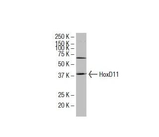 Anti-HoxD11 Antibody (R-26) | SCBT - Santa Cruz Biotechnology