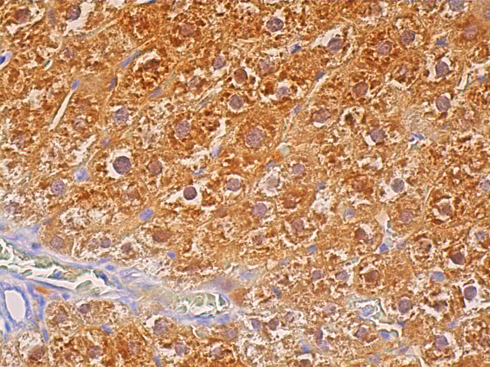 HPPD Antibody (B-11) | SCBT - Santa Cruz Biotechnology