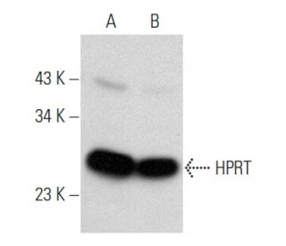 Anti-HPRT Antibody (A-10) | SCBT - Santa Cruz Biotechnology