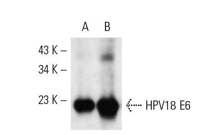 HPV16 E6/18 E6 Antibody (C1P5) | SCBT - Santa Cruz Biotechnology