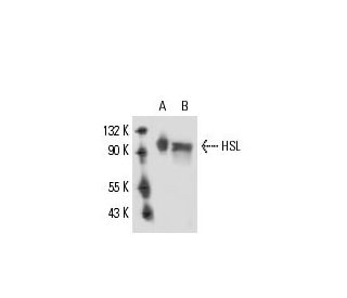 Anti-HSL Antibody (G-7) | SCBT - Santa Cruz Biotechnology