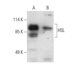 Anti-HSL Antibody (G-7) | SCBT - Santa Cruz Biotechnology