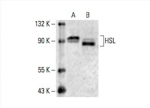 Anti-HSL Antibody (G-7) | SCBT - Santa Cruz Biotechnology