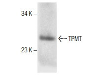 human bone marrow extract | SCBT - Santa Cruz Biotechnology