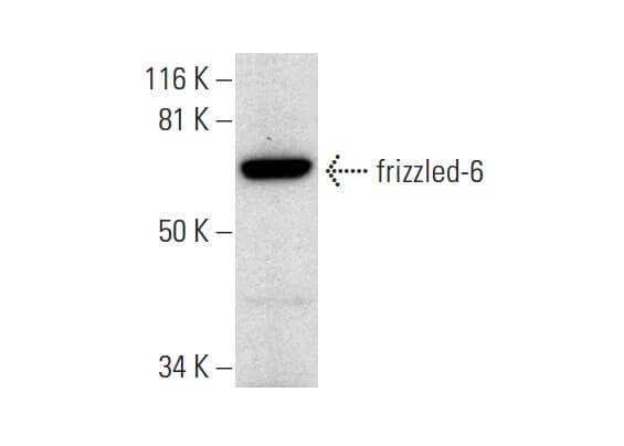 human heart extract | SCBT - Santa Cruz Biotechnology