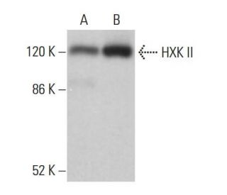 HXK II Antibody (B-8) - Western Blotting - Image 377582