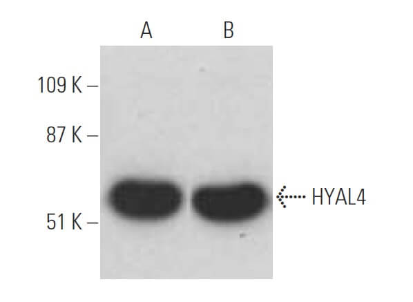 Anti-HYAL4 Antibody (A-7) | SCBT - Santa Cruz Biotechnology