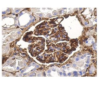 ICAM-1 Antibody (G-5) - Immunohistochemistry - Image 156529