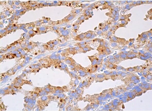 Anti-IFIT3 Antibody (B-7) | SCBT - Santa Cruz Biotechnology
