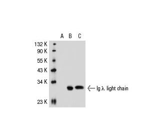 Ig λ light chain Antibody (ICO106) - Western Blotting - Image 30455