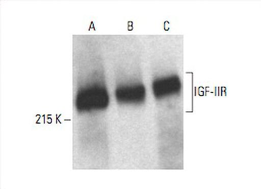 IGF2R/M6PR抗体 (29) | SCBT - Santa Cruz Biotechnology