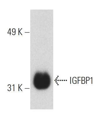 Anti-IGFBP1 Antibody (H-3) | SCBT - Santa Cruz Biotechnology