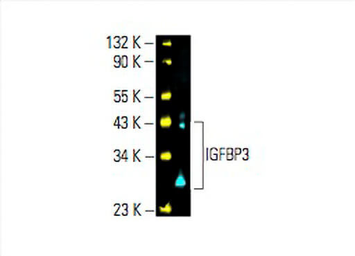 Anti-IGFBP3 Antibody (E-9) | SCBT - Santa Cruz Biotechnology