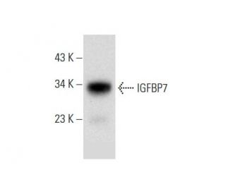 IGFBP7 Antibody (H-3) | SCBT - Santa Cruz Biotechnology