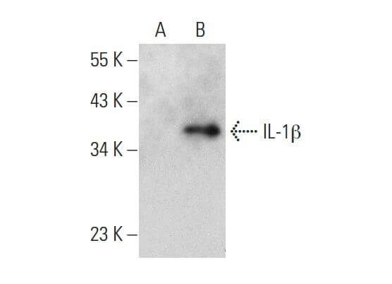 IL-1 beta/IL1B抗体 (F-5) | SCBT - Santa Cruz Biotechnology