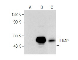 Anti-ILKAP Antibody (41) | SCBT - Santa Cruz Biotechnology