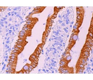 ImmunoCruz® goat LSAB Staining System | SCBT - Santa Cruz Biotechnology