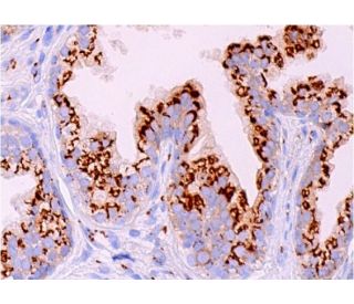 ImmunoCruz® goat LSAB Staining System | SCBT - Santa Cruz Biotechnology