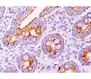 ImmunoCruz® goat LSAB Staining System | SCBT - Santa Cruz Biotechnology