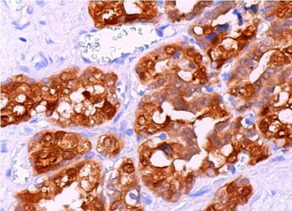 ImmunoCruz® goat LSAB Staining System | SCBT - Santa Cruz Biotechnology