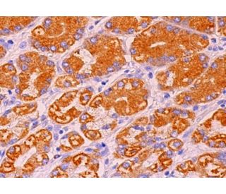 ImmunoCruz® goat LSAB Staining System | SCBT - Santa Cruz Biotechnology
