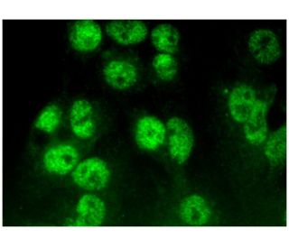 ING2 Antibody (B-5) | SCBT - Santa Cruz Biotechnology