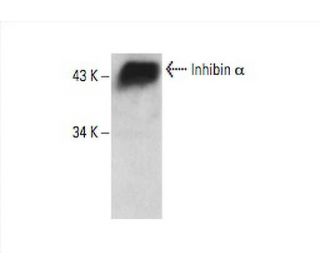 Anti-Inhibin α Antibody (D-4) | SCBT - Santa Cruz Biotechnology