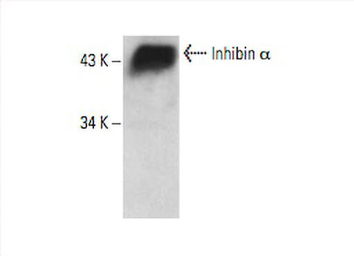 Anti-Inhibin α Antibody (D-4) | SCBT - Santa Cruz Biotechnology