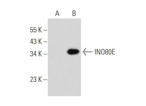 INO80E Antibody (B-6) | SCBT - Santa Cruz Biotechnology