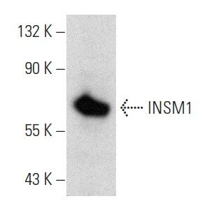 INSM1 Antibody (C-1) | SCBT - Santa Cruz Biotechnology