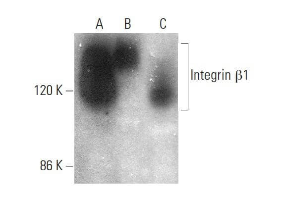 Integrin β1/ITGB1 Antibody (JB1B) | SCBT - Santa Cruz Biotechnology