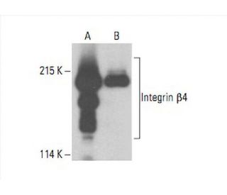 Integrin β4 Antibody (B-7) - Western Blotting - Image 392878
