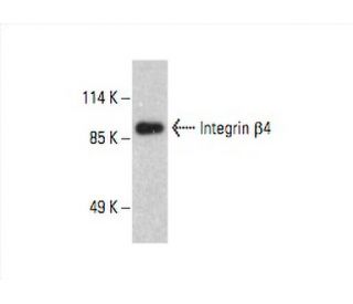 Anti-Integrin β4/ITGB4/CD104 Antibody (G-7) | SCBT - Santa Cruz Biotechnology