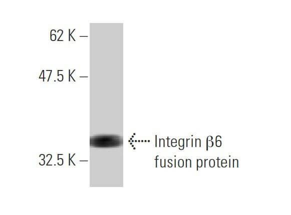 Integrin β6/ITGB6 Antibody (4C3) | SCBT - Santa Cruz Biotechnology
