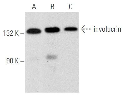 involucrin Antibody (A-5) | SCBT - Santa Cruz Biotechnology