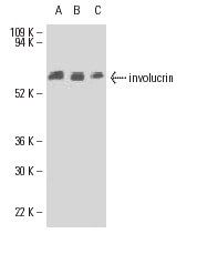 involucrin 항체 (H-120) | SCBT - Santa Cruz Biotechnology