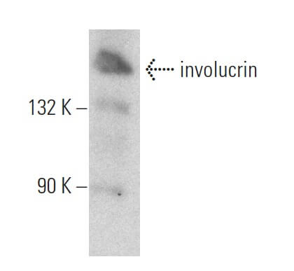 Anti-involucrin Antibody (SY5) | SCBT - Santa Cruz Biotechnology