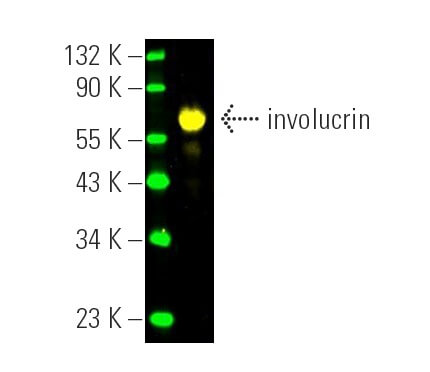 Anti-involucrin Antibody (SY5) | SCBT - Santa Cruz Biotechnology