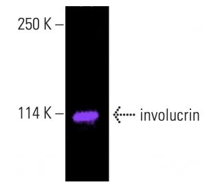 involucrin Antibody (SY5) - Western Blotting - Image 402065