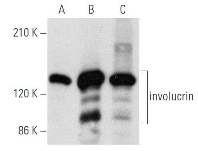 involucrin Antibody (SY8) | SCBT - Santa Cruz Biotechnology