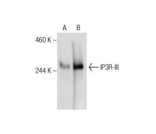 IP3R-I/II/III Antibody (B-2) - Western Blotting - Image 158478