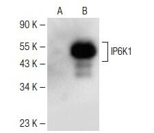 IP6K1 Antibody (A-10) | SCBT - Santa Cruz Biotechnology